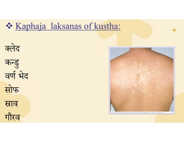 KUSTHA PPT .pdf KUSTHA definition, classification, and modern probable ...