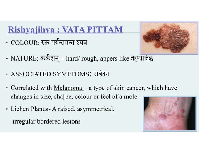 KUSTHA PPT .pdf KUSTHA definition, classification, and modern probable ...