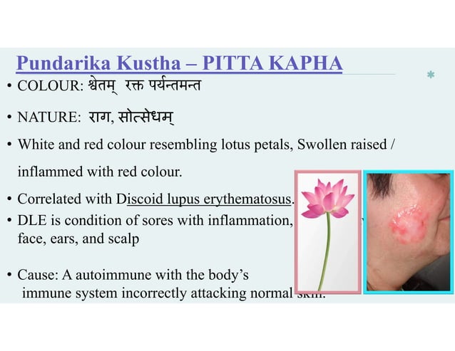 KUSTHA PPT .pdf KUSTHA definition, classification, and modern probable ...