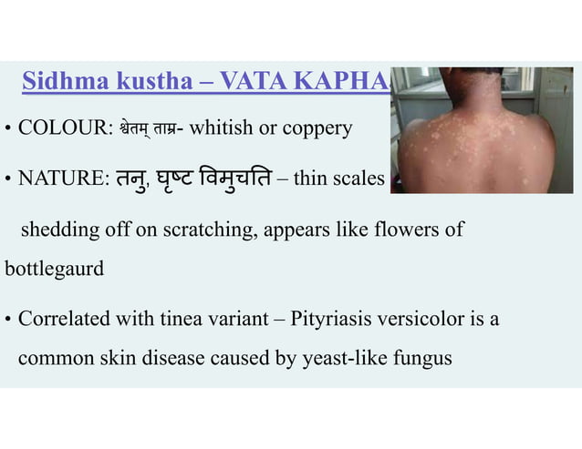 KUSTHA PPT .pdf KUSTHA definition, classification, and modern probable ...