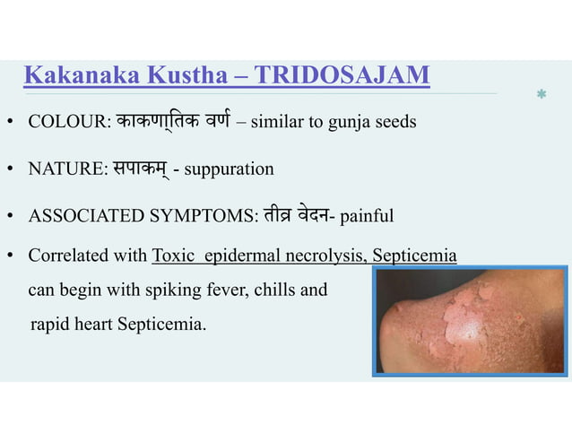 KUSTHA PPT .pdf KUSTHA definition, classification, and modern probable ...