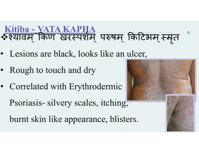 KUSTHA PPT .pdf KUSTHA definition, classification, and modern probable ...