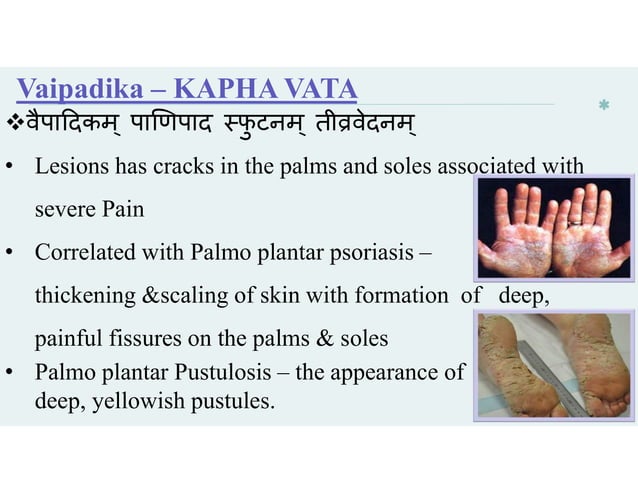 KUSTHA PPT .pdf KUSTHA definition, classification, and modern probable ...