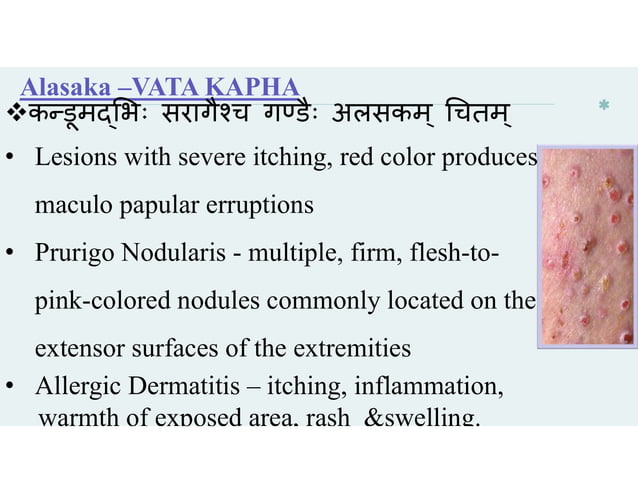 KUSTHA PPT .pdf KUSTHA definition, classification, and modern probable ...