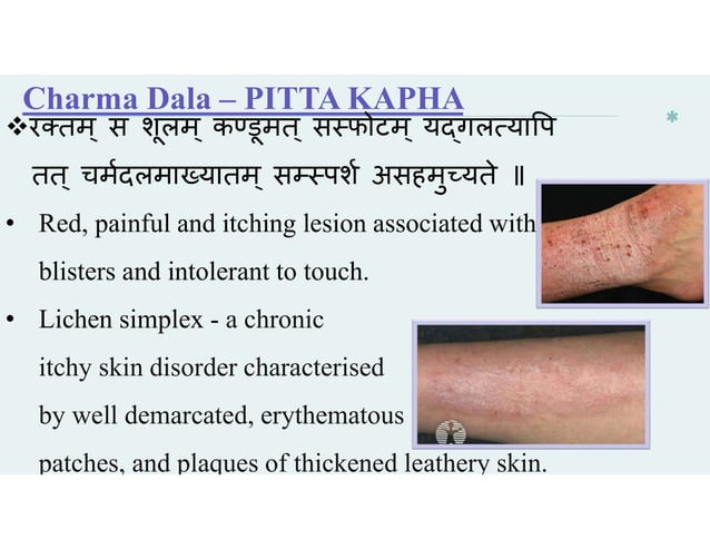 KUSTHA PPT .pdf KUSTHA definition, classification, and modern probable ...