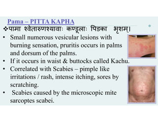 KUSTHA PPT .pdf KUSTHA definition, classification, and modern probable ...