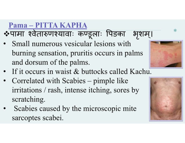 KUSTHA PPT .pdf KUSTHA definition, classification, and modern probable ...