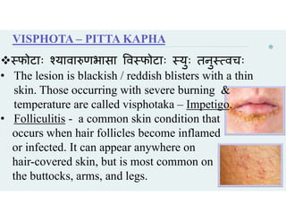 KUSTHA PPT .pdf KUSTHA definition, classification, and modern probable ...