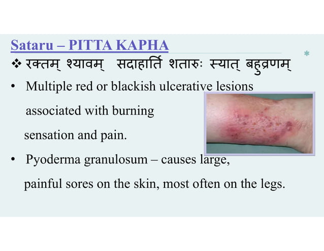 KUSTHA PPT .pdf KUSTHA definition, classification, and modern probable ...
