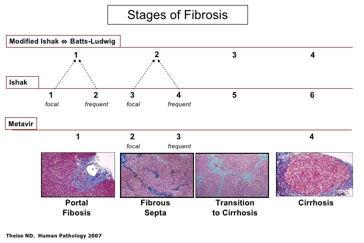 Chronic Viral Hepatitis - Part 1 - Kuwait