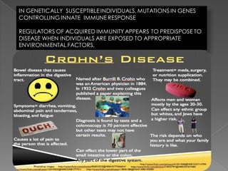 Crohn,s disease | PDF
