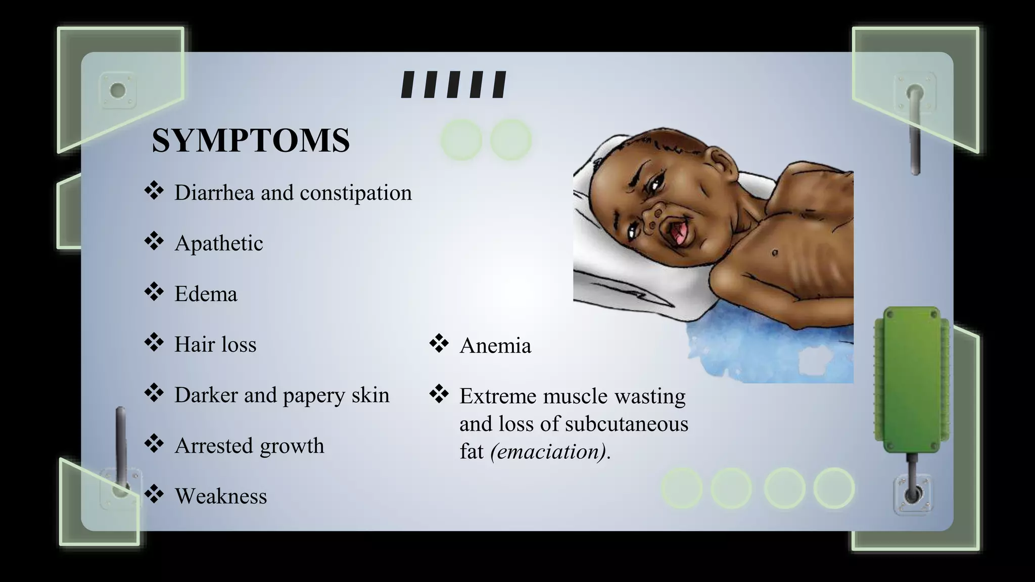 KWASHIORKOR-MARASMUS-GROUP-4-1.pptx
