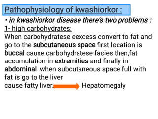 kwashiorkor disease .pdf