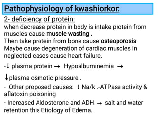 kwashiorkor disease .pdf