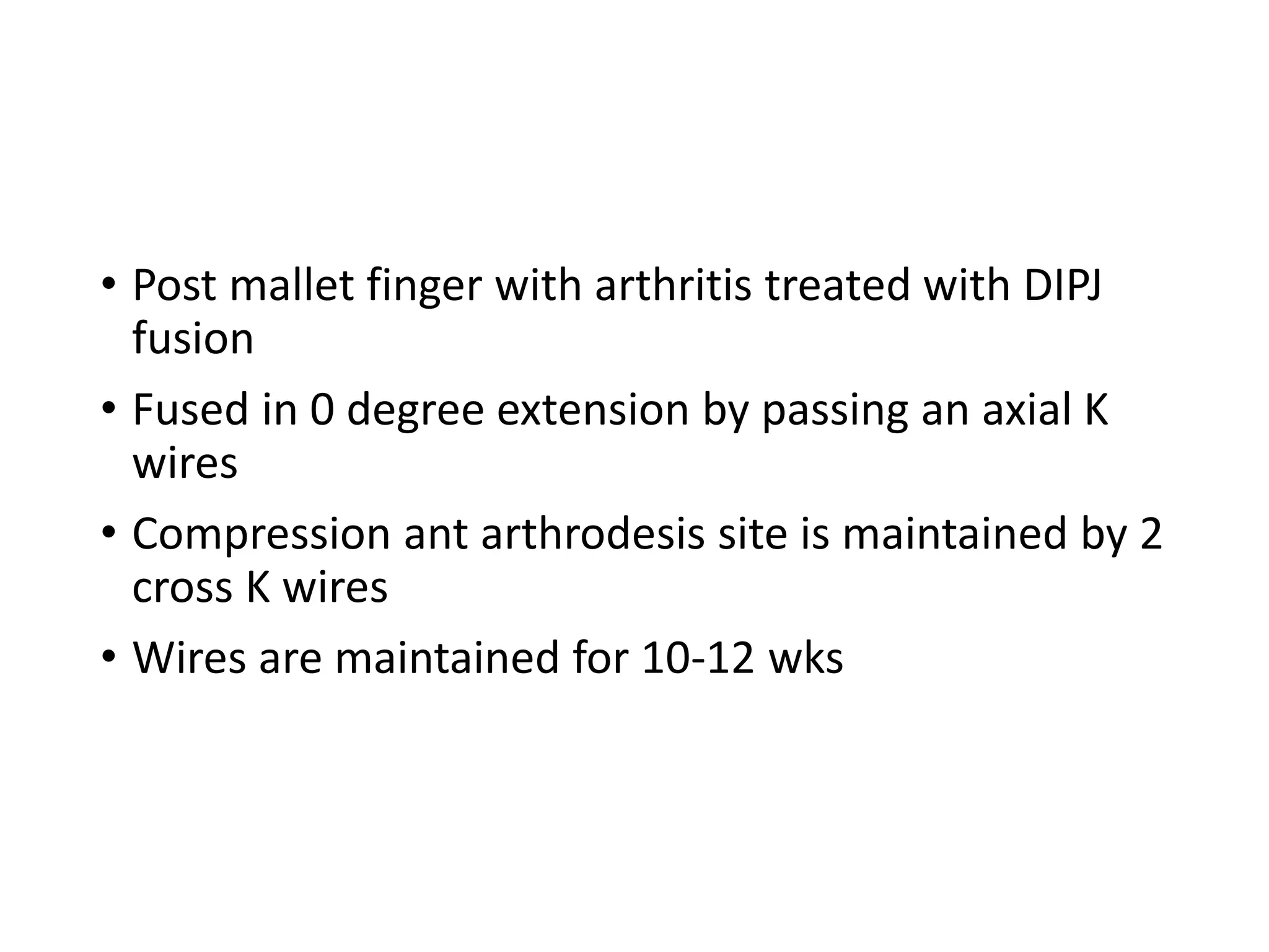K WIRE FIXATION-Basics.pptx