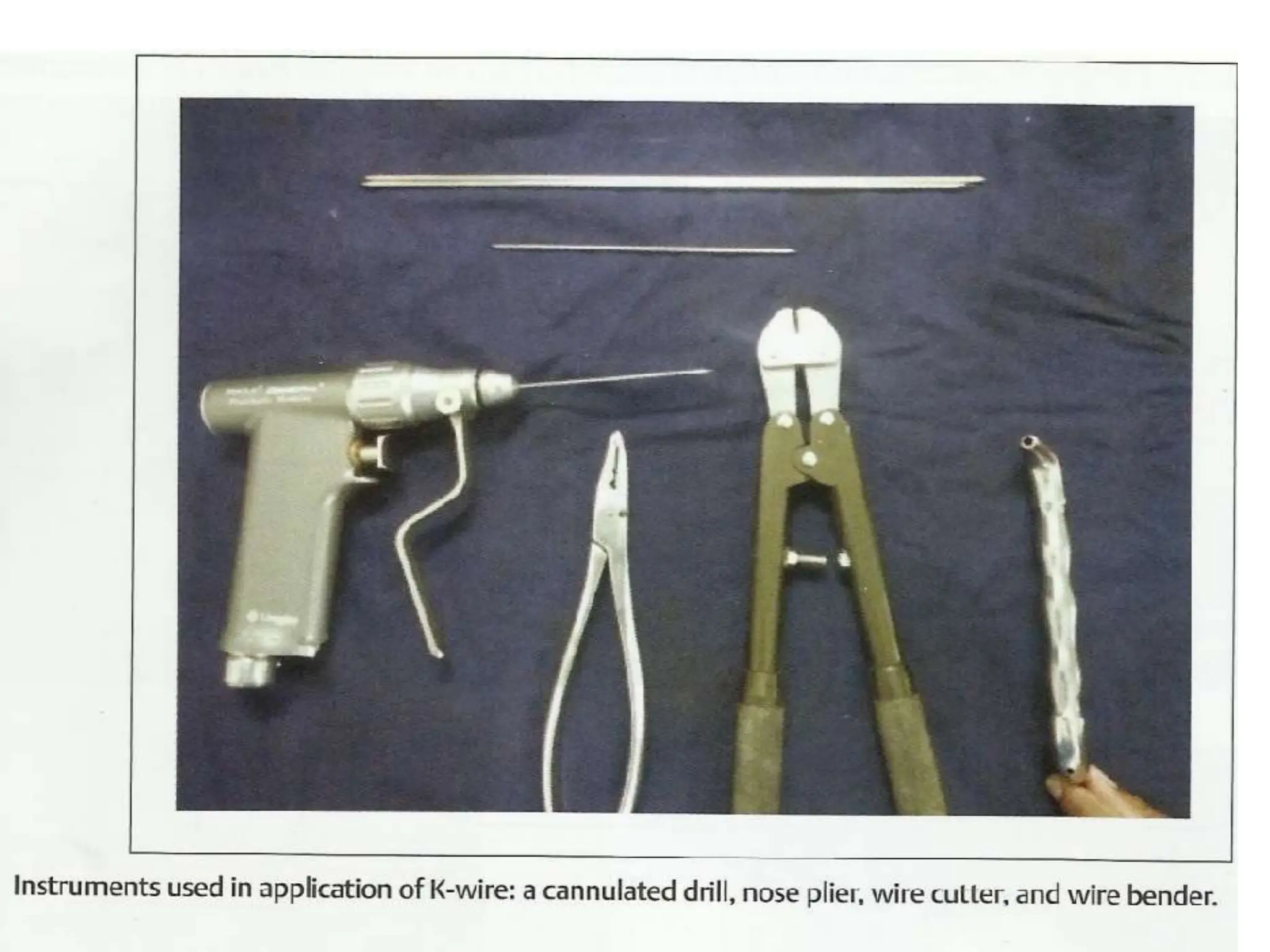 K WIRE FIXATION-Basics.pptx