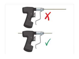 K WIRE FIXATION-Basics.pptx