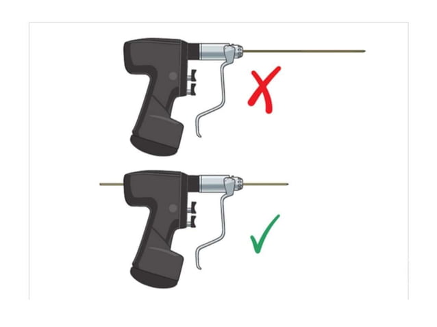 K WIRE FIXATION-Basics.pptx | First Aid | Injuries