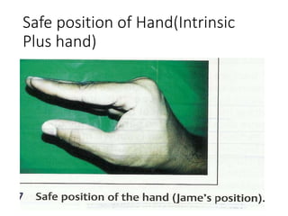K WIRE FIXATION-Basics.pptx