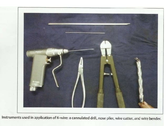 K WIRE FIXATION-Basics.pptx | First Aid | Injuries