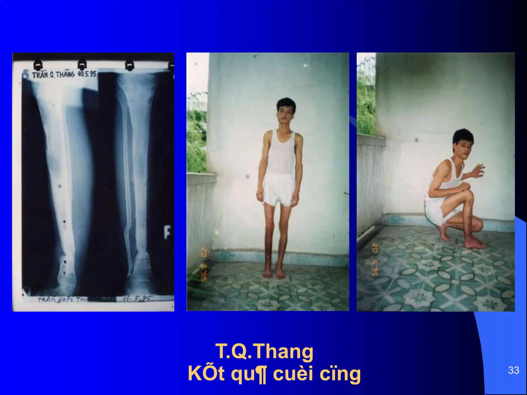 KXCD-NE-VM (Tieng viet) trong ngon ngu.ppt
