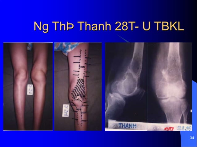 KXCD-NE-VM (Tieng viet) trong ngon ngu.ppt