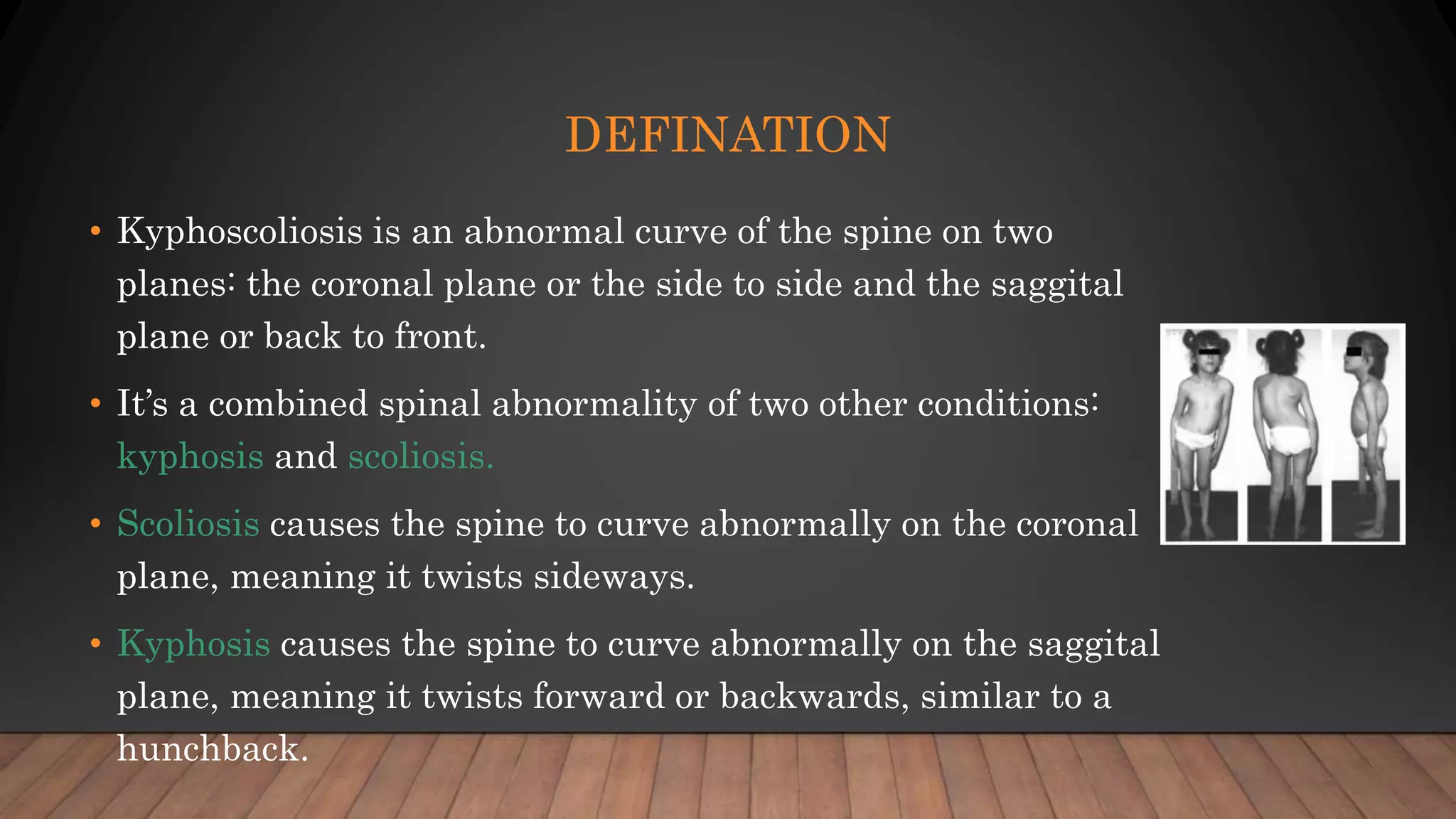 Kyphoscoliosis | PPTX