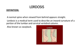 KYPHOSIS-1.pptx biomechanics. ........... | PPTX