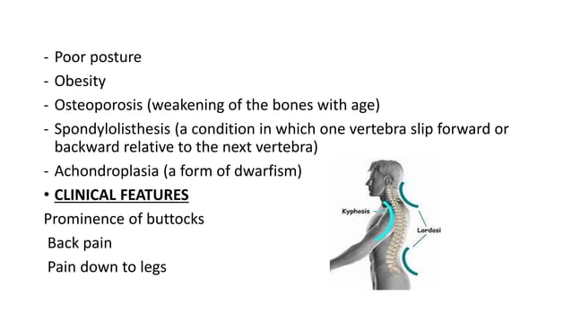 KYPHOSIS-1.pptx biomechanics. ........... | PPT
