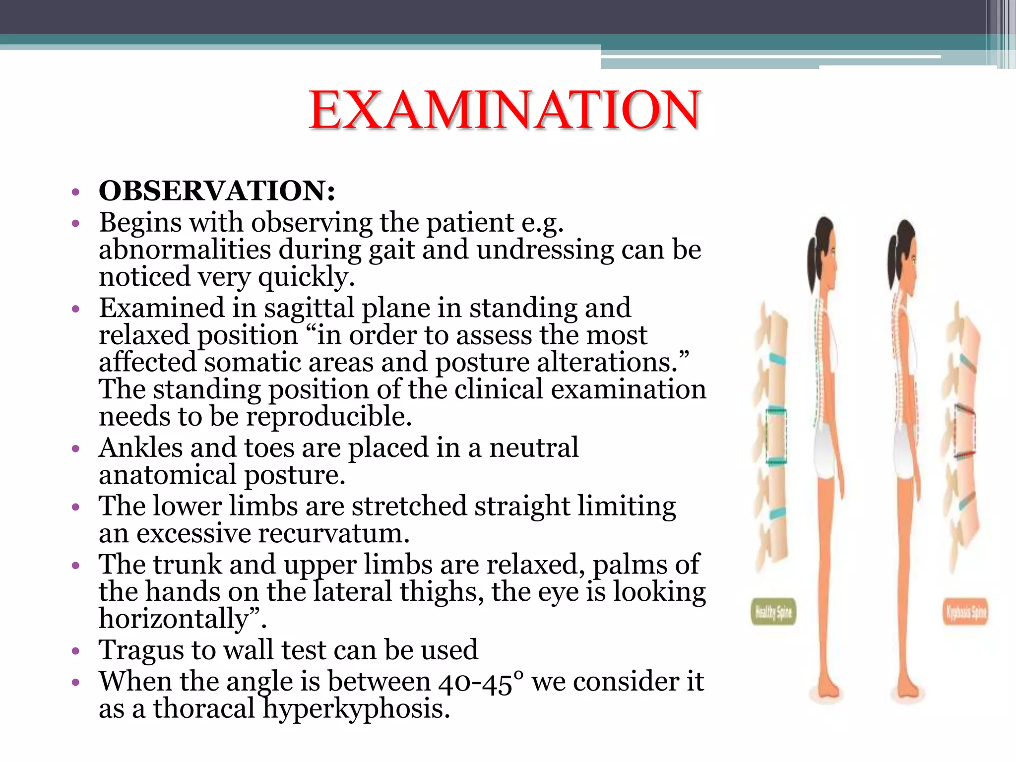 Kyphosis | PPTX