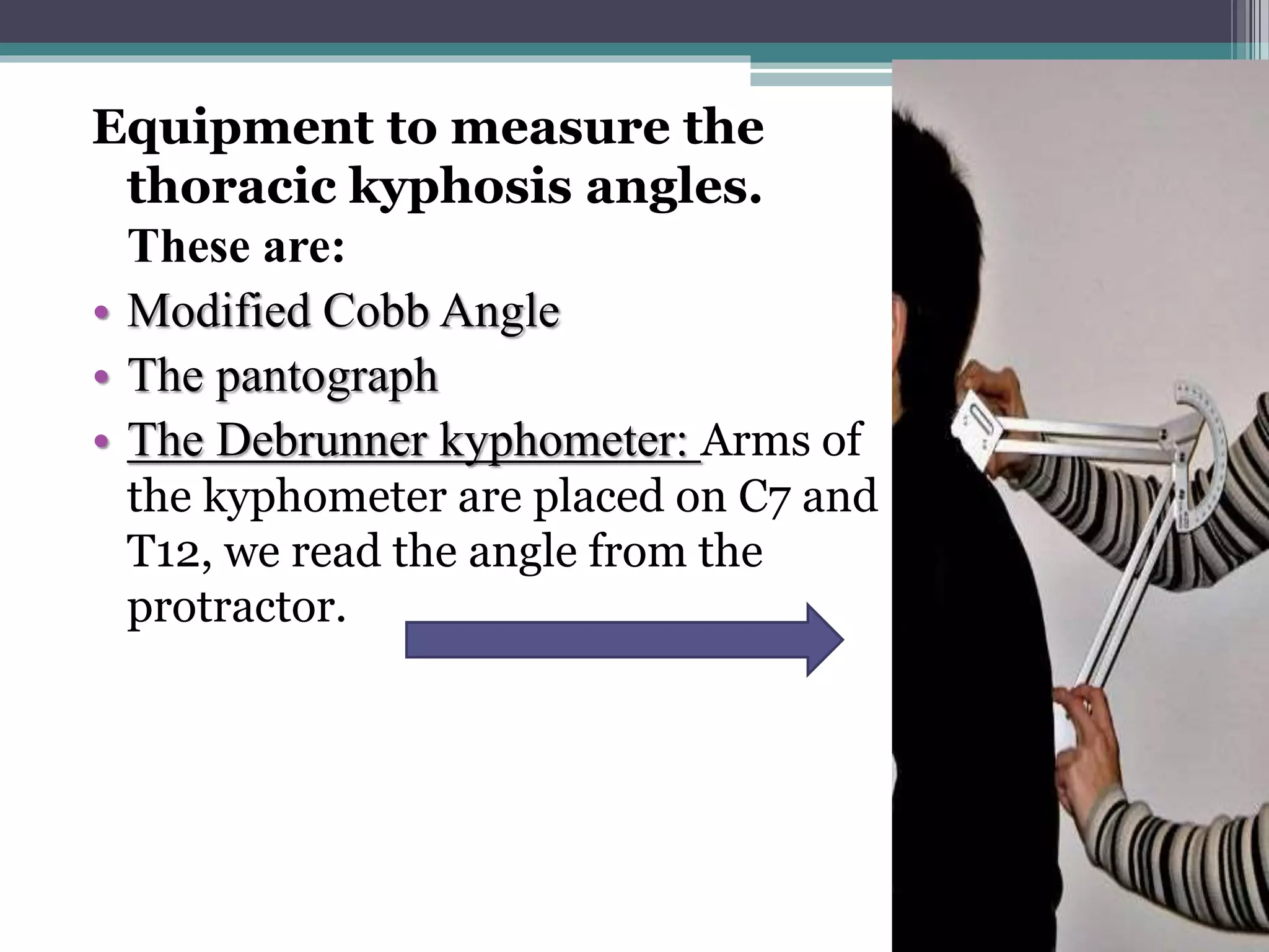 Kyphosis | PPTX