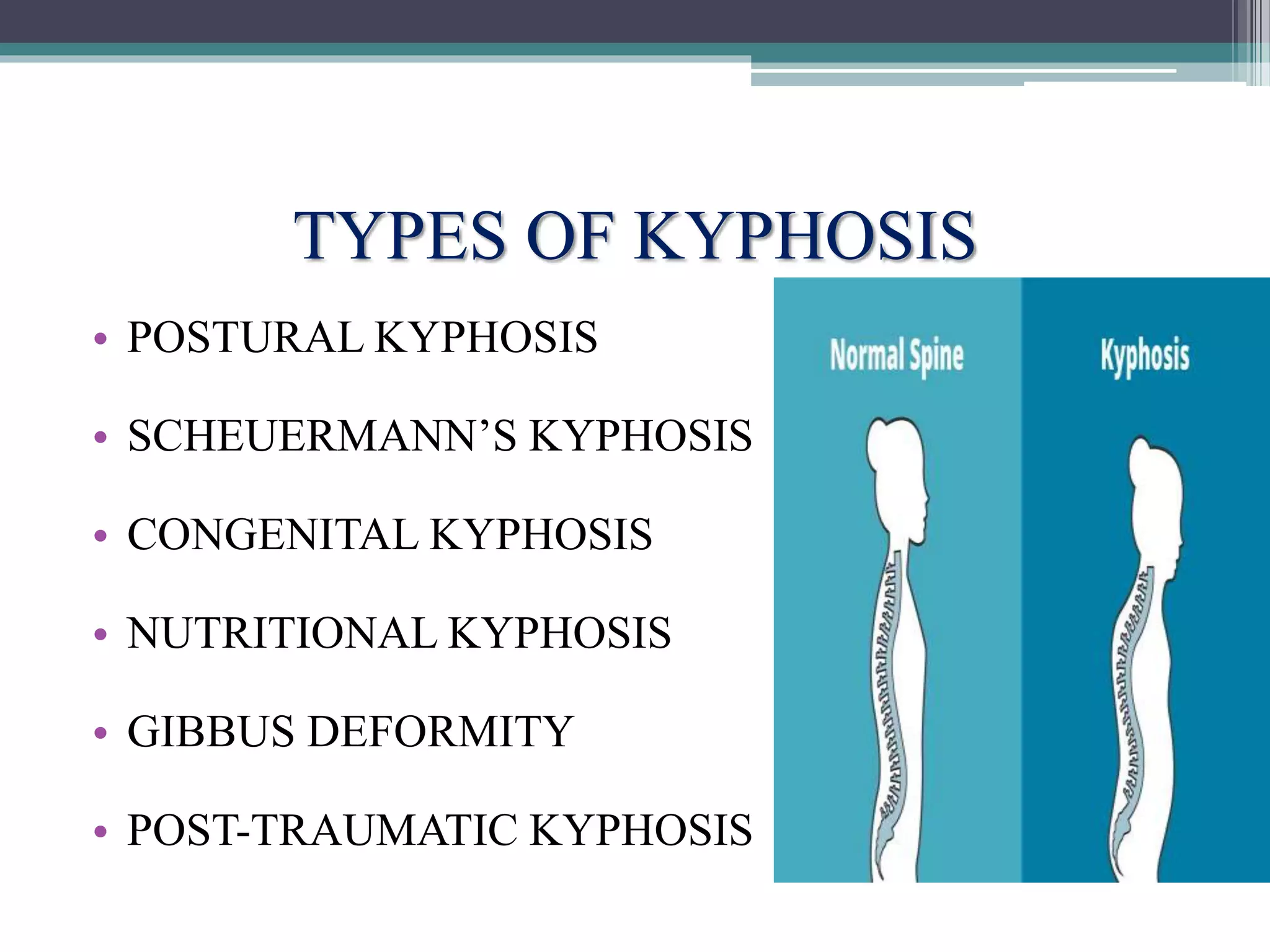 Kyphosis | PPTX