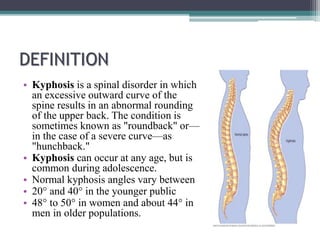 Kyphosis | PPT