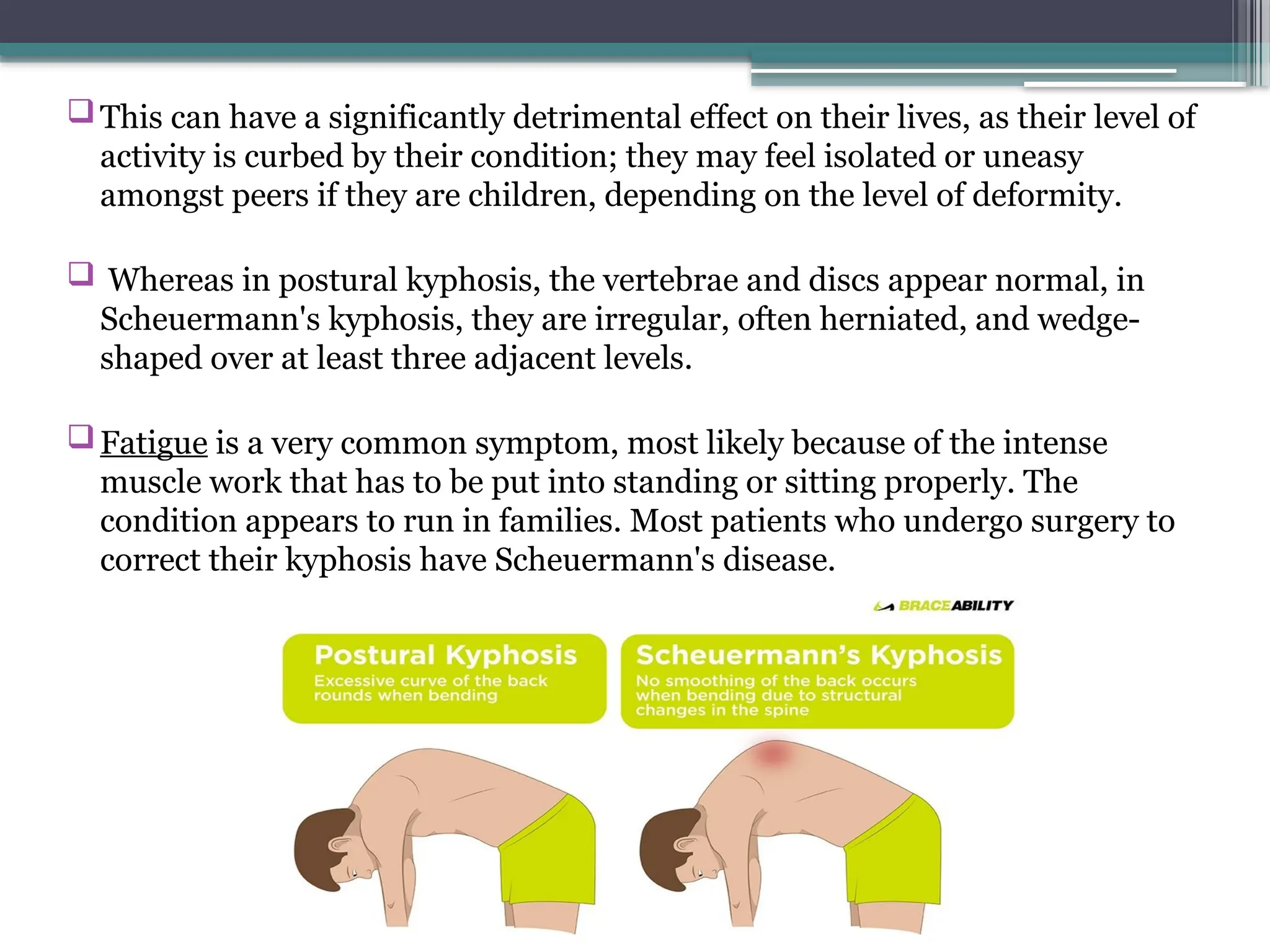 Acquired disease in kyphosis-00014769.pptx