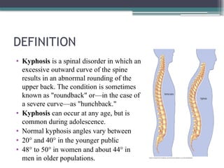 Acquired disease in kyphosis-00014769.pptx