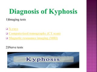 Kyphosis.pptx