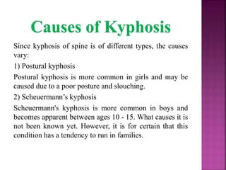 Kyphosis.pptx