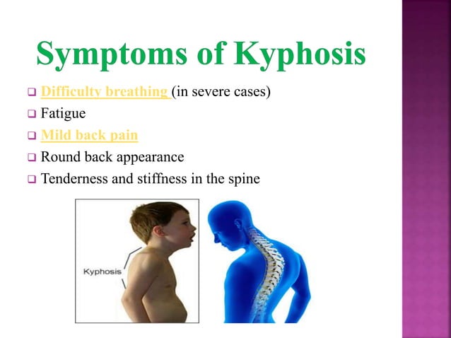 Kyphosis.pptx