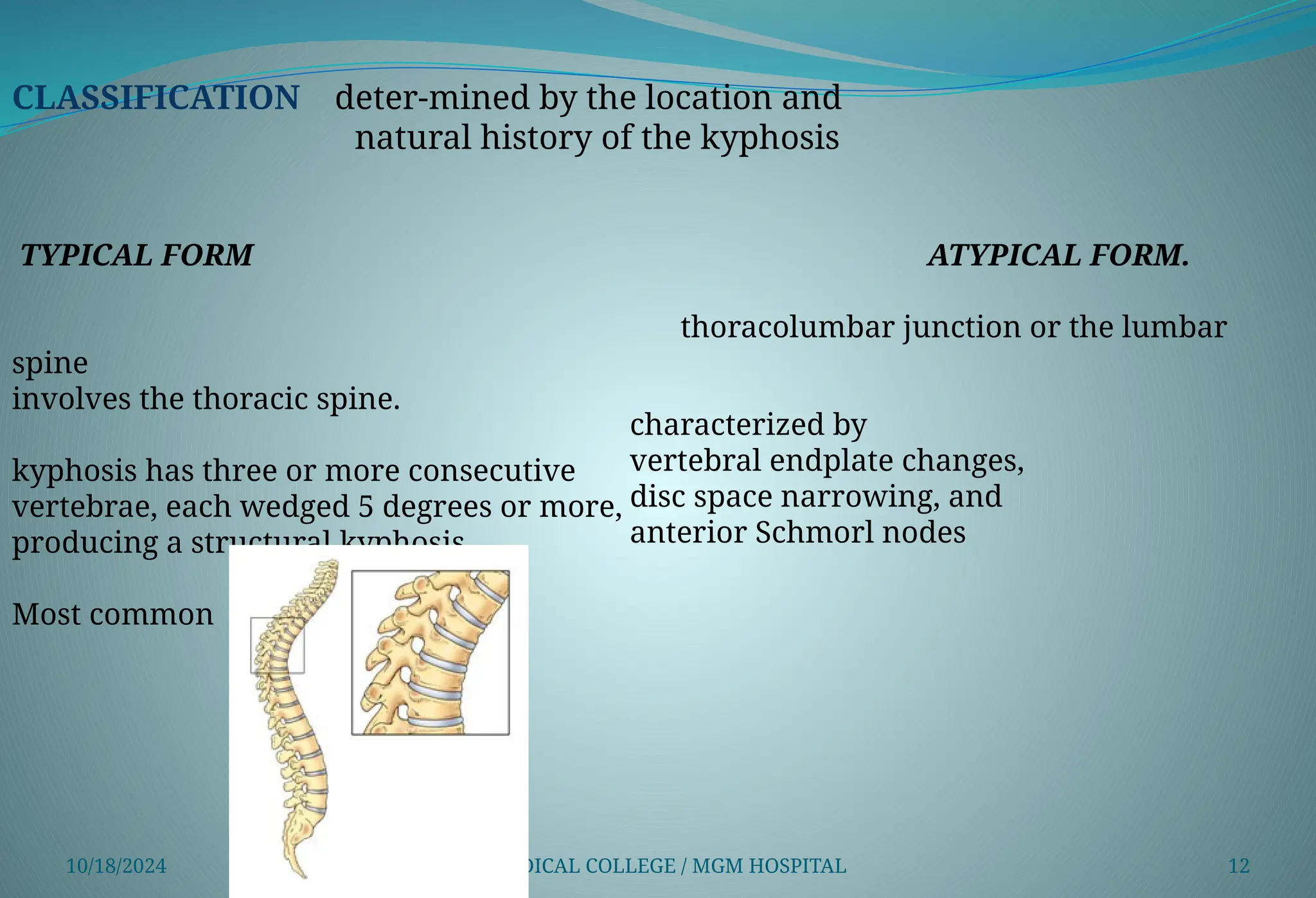 KYPHOSIS.pptx KYPHOSIS DEFORMITY OF THE SPINE | PPTX