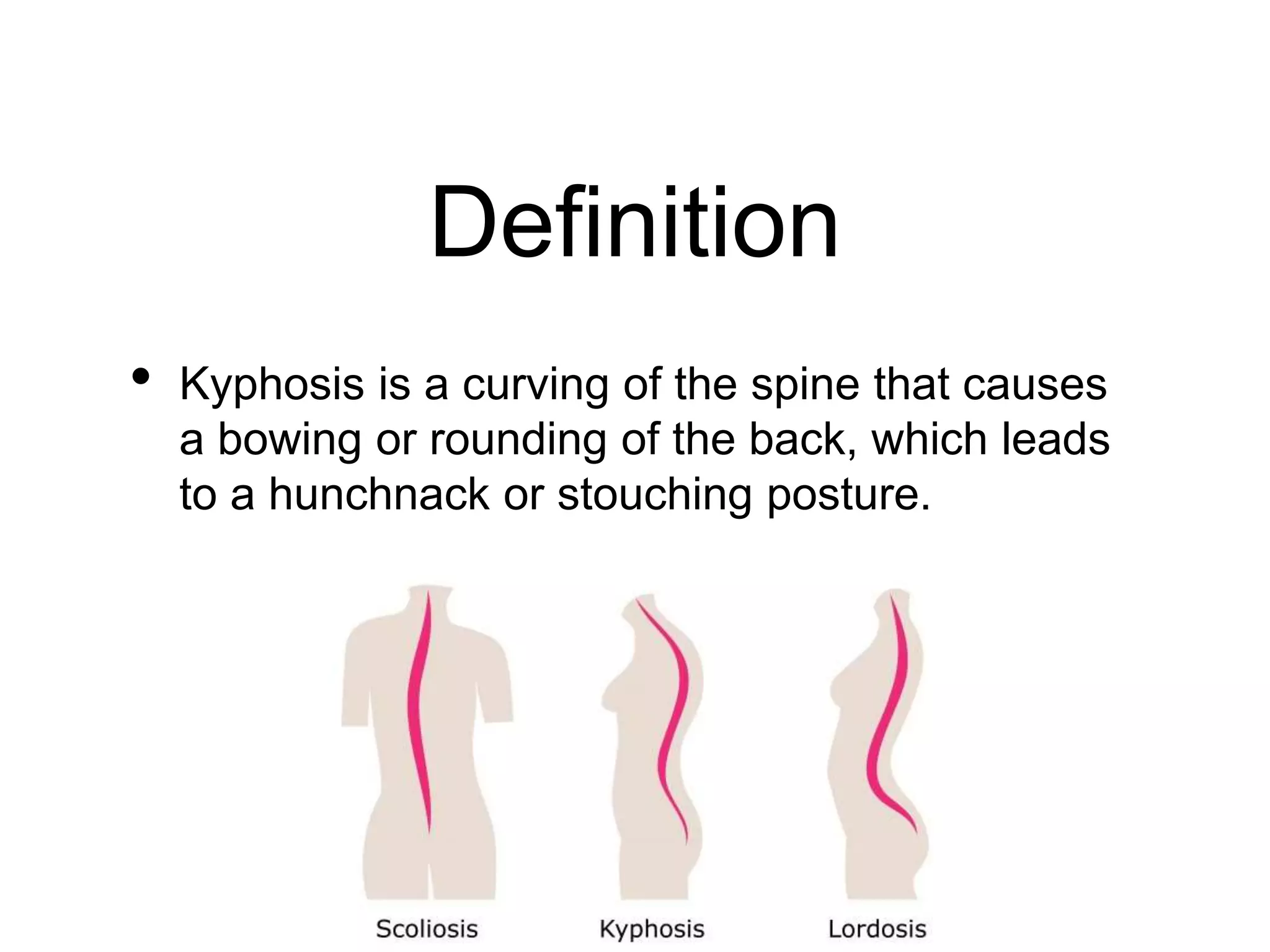 Kyphosis and Lordosis | PPTX