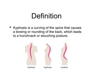 Kyphosis lordosis- | PPTX
