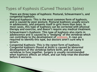 Kyphosis (curved thoracic spine) | PPTX