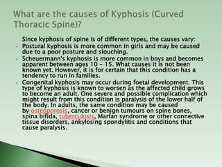 Kyphosis (curved thoracic spine) | PPTX