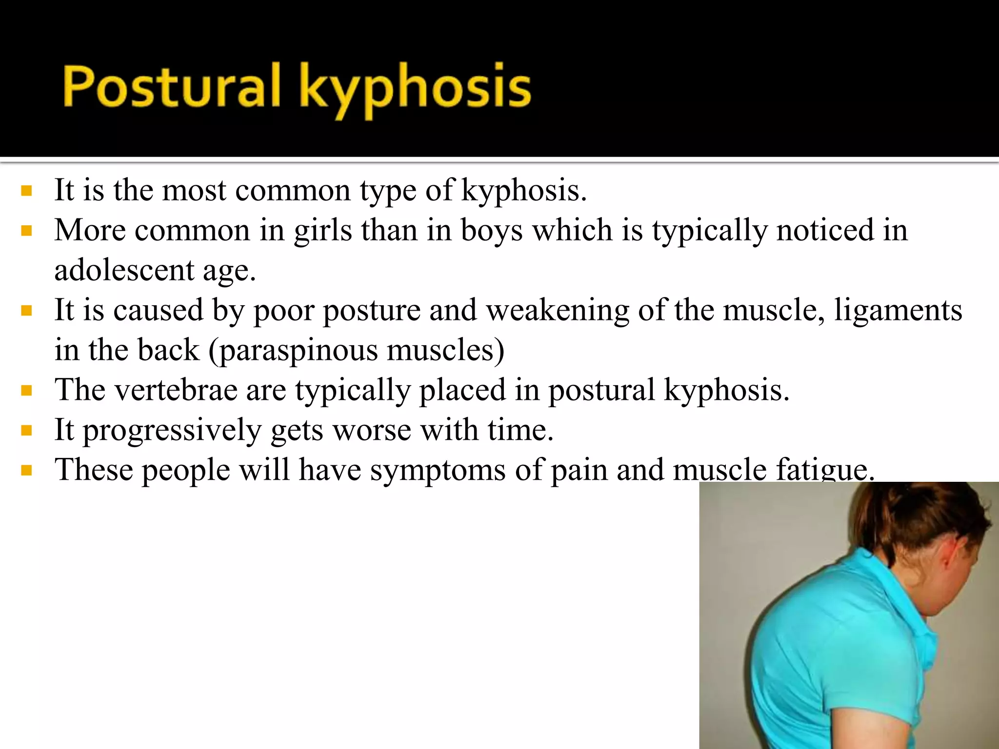 Kyphosis lordosis | PPTX