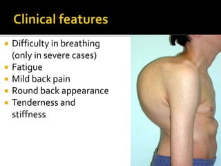 Kyphosis lordosis | PPTX