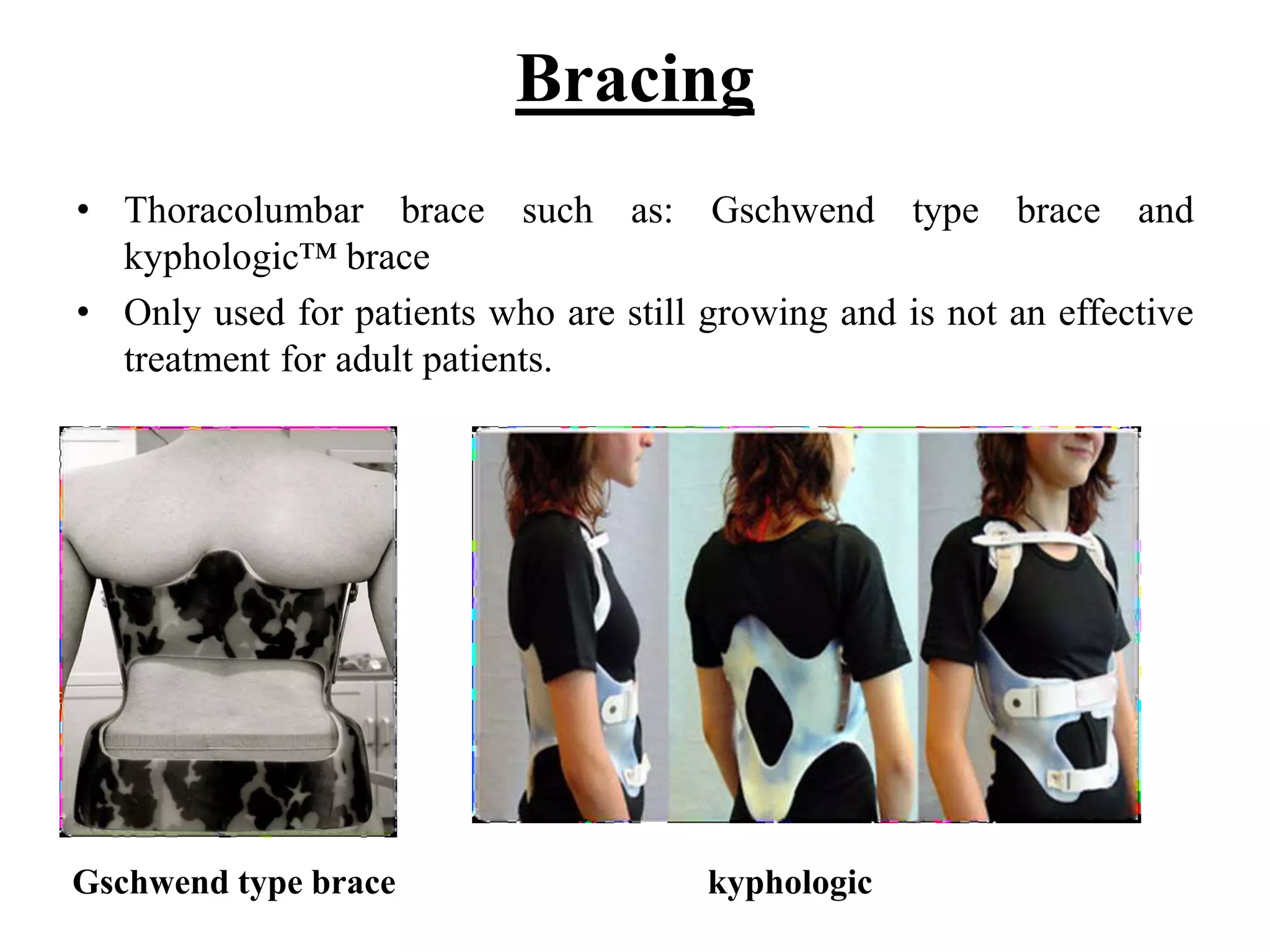 KYPHOSIS LORDOSIS.pdf