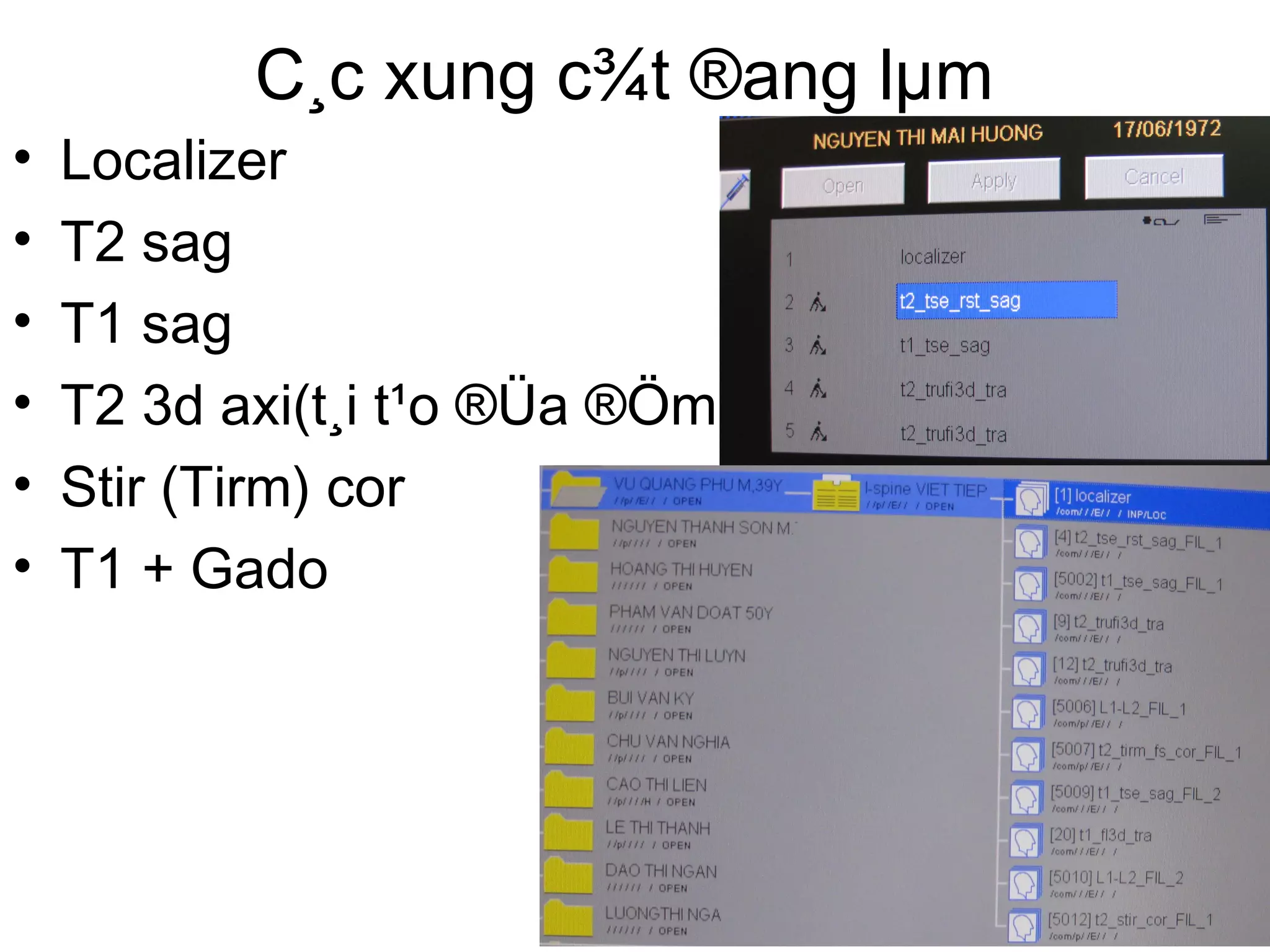 Ky thuat chup mri cstl | PPT