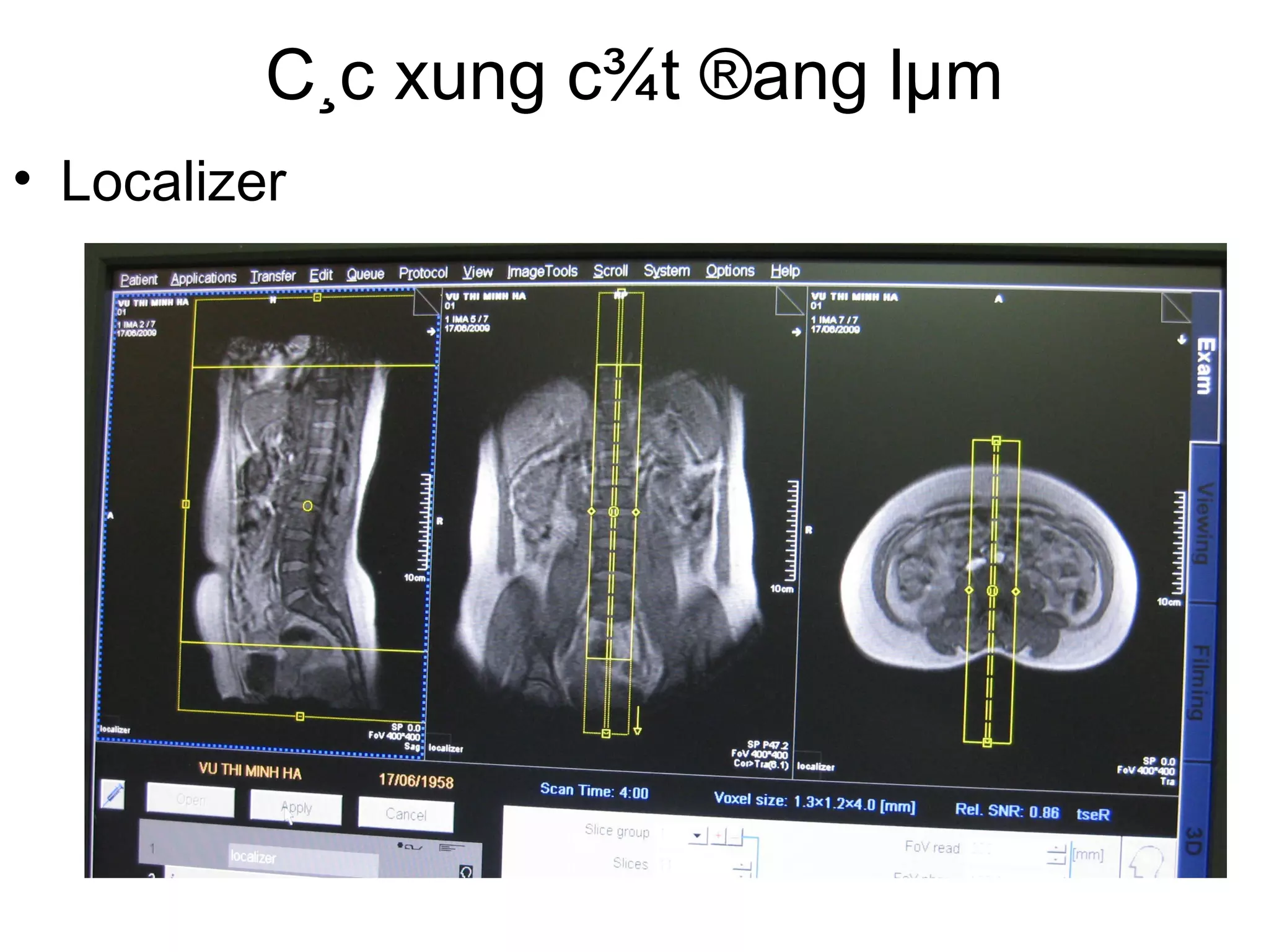 Ky thuat chup mri cstl | PPT