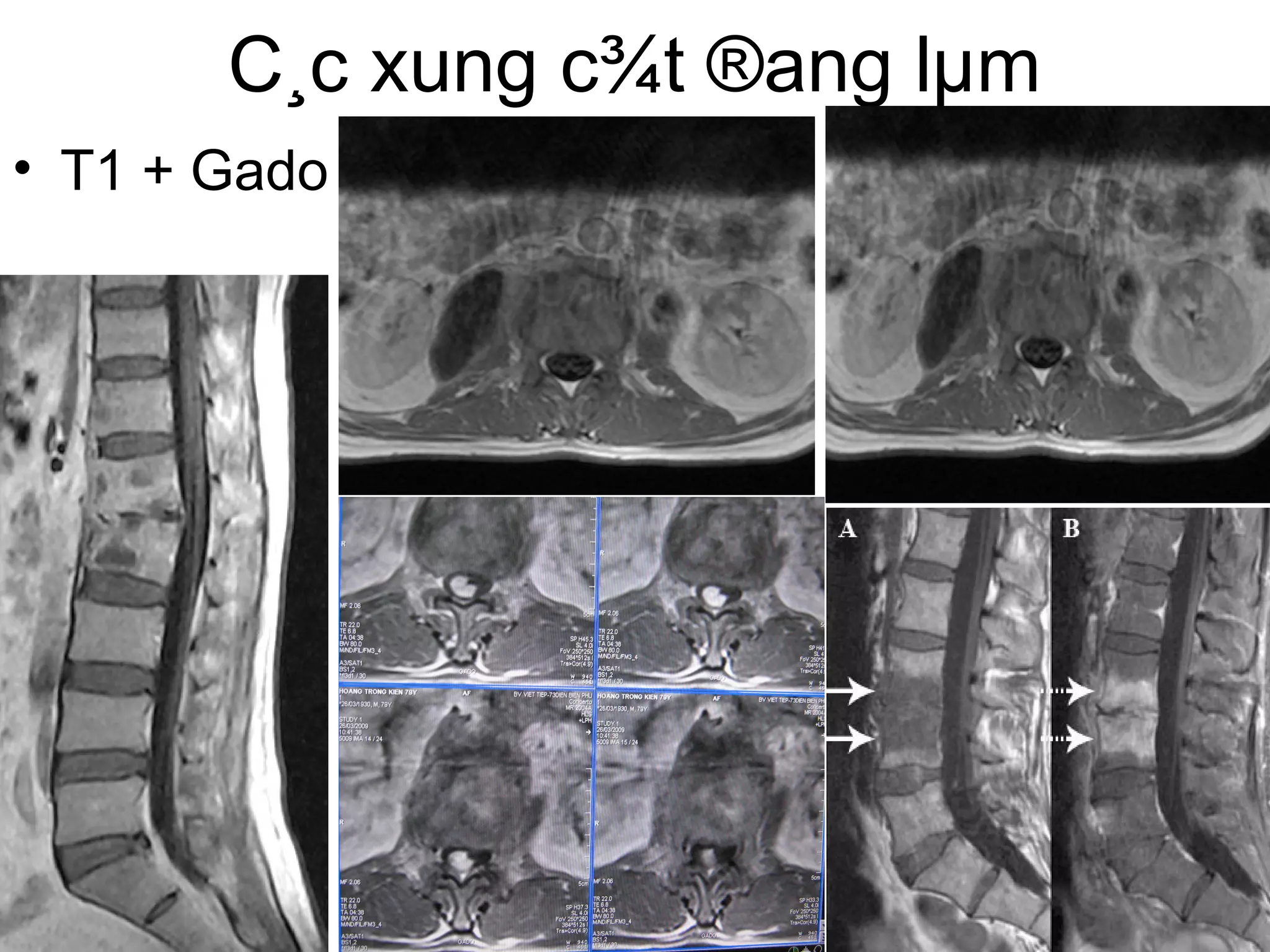 Ky thuat chup mri cstl | PPT