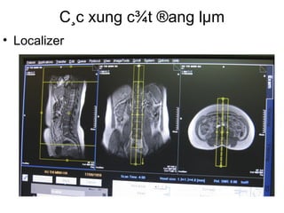 Ky thuat chup mri cstl | PPT